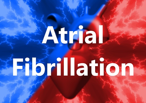 Assessing the Effects of Intracranial Atherosclerosis and AFib on the ...