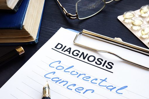 Colorectal Cancer Screening Suggests Many Cases of Undiagnosed Cancer ...