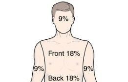 Skin GVHD and the Rule of Nines | Cancer Nursing Today