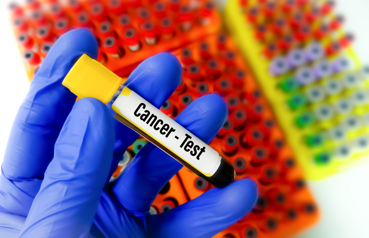 NHS-Galleri Multi-Cancer Early Detection Test Falls Short of Key Goal ...