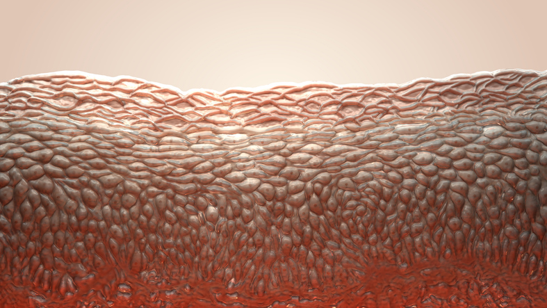 Seborrheic Dermatitis Linked to Other Epithelial Barriers Diseases ...