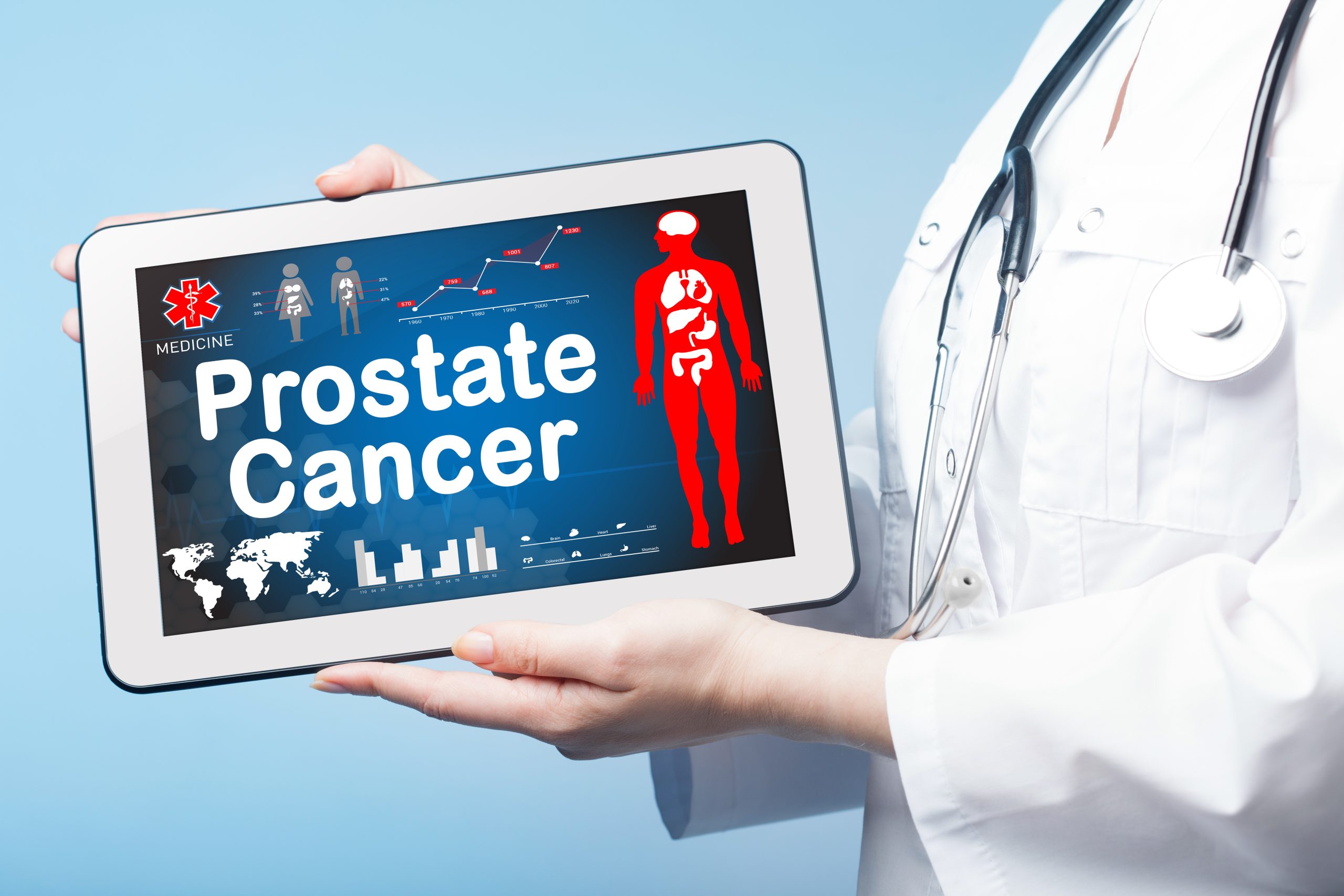 Identifying Novel Target Discoveries in Prostate Cancer | GU Oncology Now