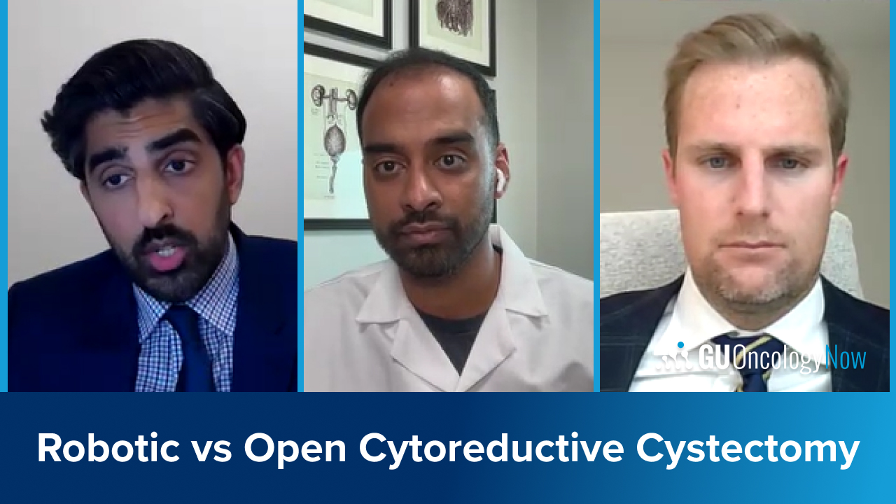 Robotic Versus Open Cytoreductive Cystectomy | GU Oncology Now